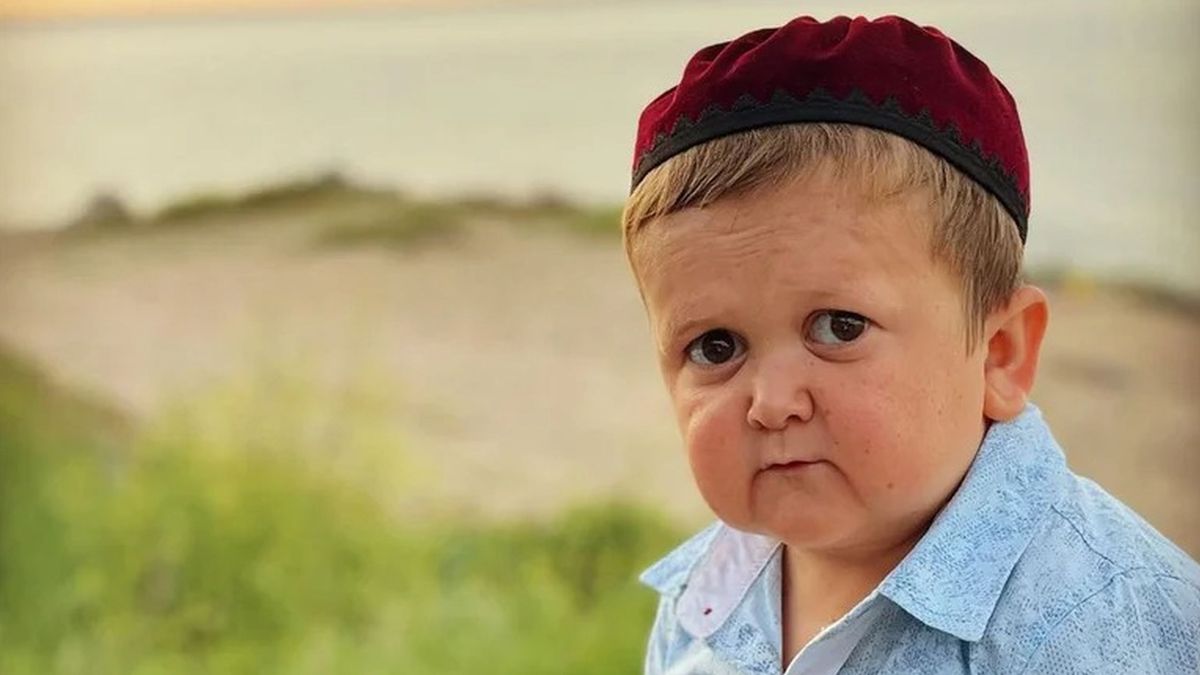 Qué enfermedad genética sufre el influencer ruso Hasbulla