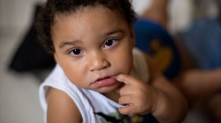 El bebé nacido con microcefalia por el zika en Brasil tiene un ...