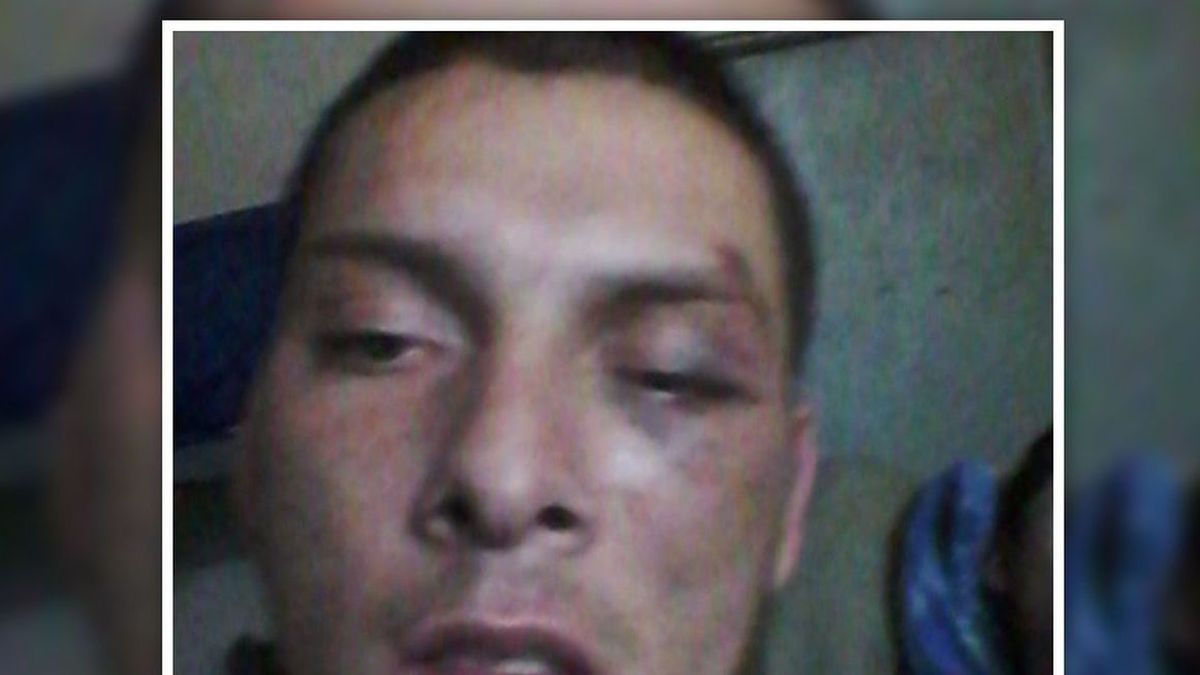 No pudo declarar porque se cosió la boca con alambre